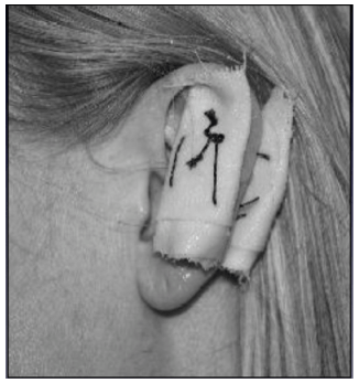 HEENT: Tips for Addressing Your Next Procedure - emdocs