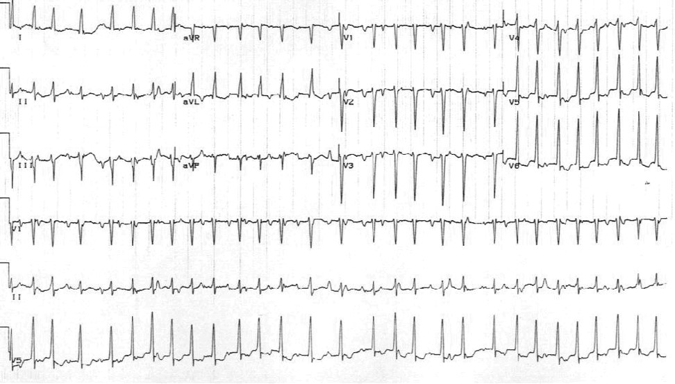 cardiovascular Archives - emdocs