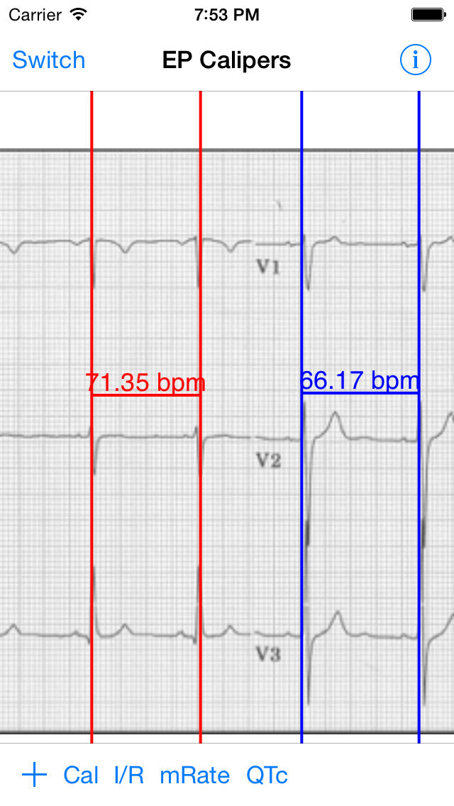 Introducing EP Calipers – EP Studios