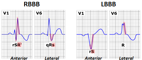 Electrocardiogram Guide (EKG/ECG) – Stepwards